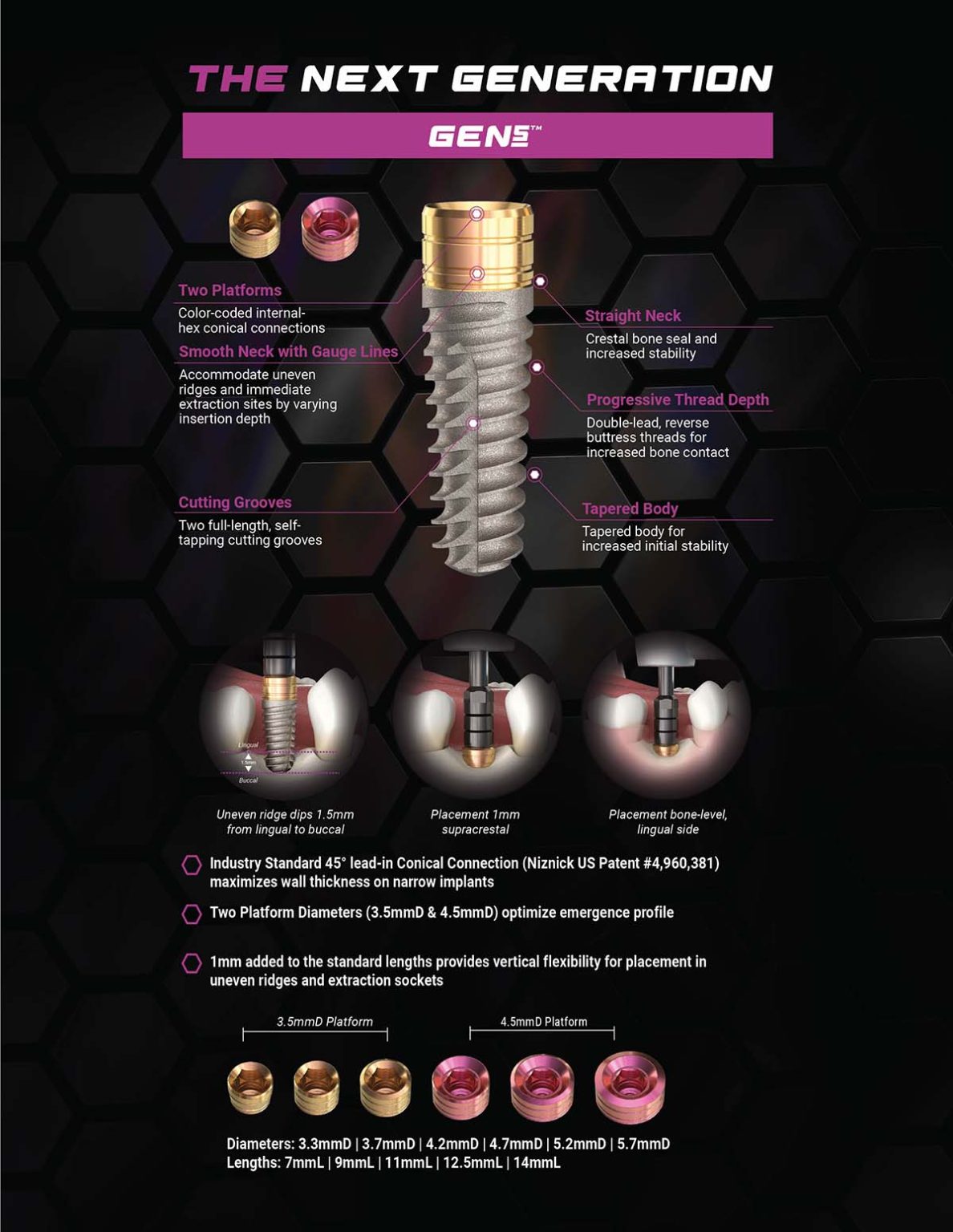 Shortcomings of NEODENT’s® GM Implants – Paragon Implant