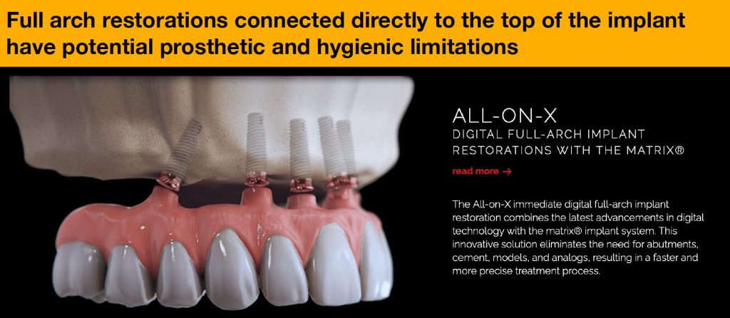Shortcomings of TRI-Dental’s® Matrix Implant – Paragon Implant