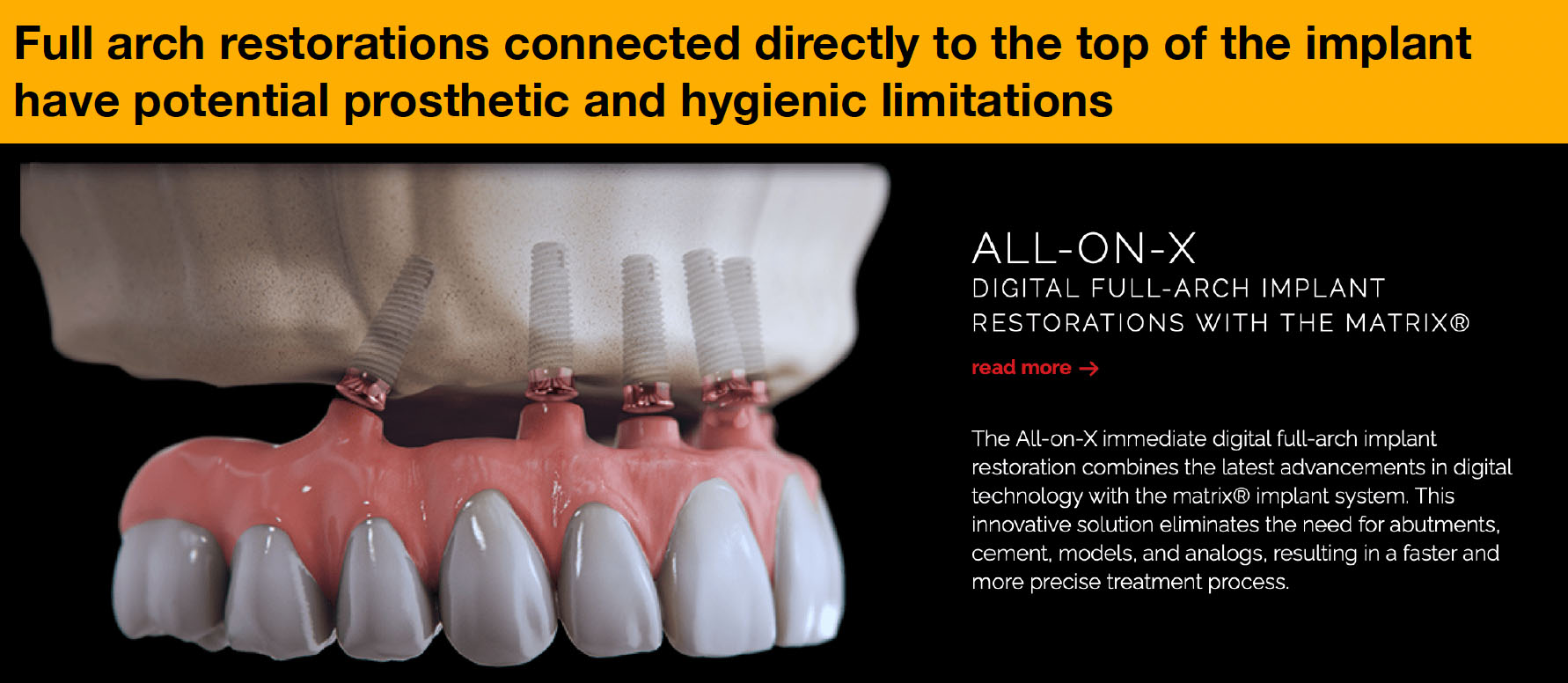 Shortcomings of TRI-Dental’s® Matrix Implant – Paragon Implant