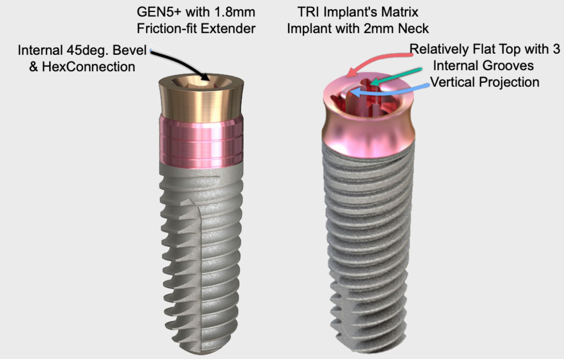 Shortcomings of TRI-Dental’s® Matrix Implant – Paragon Implant