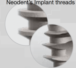 Shortcomings of NEODENT’s® GM Implants – Paragon Implant