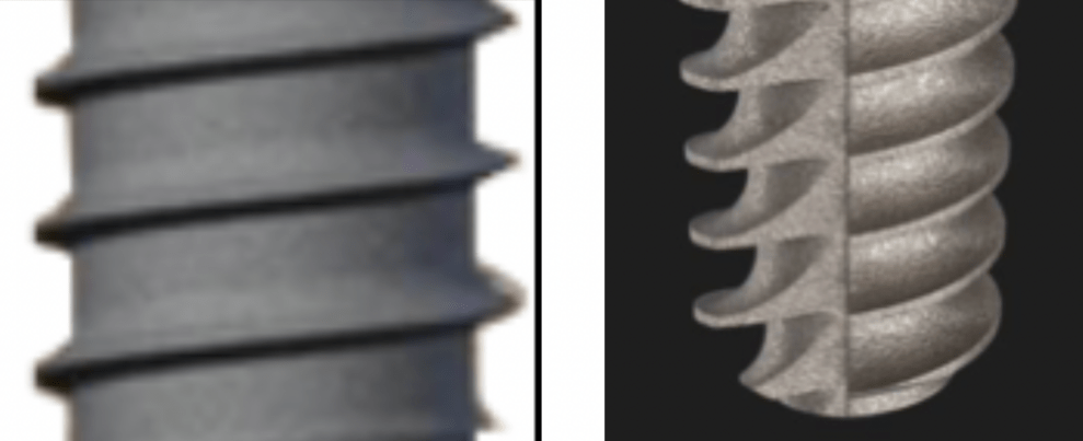 Shortcomings of NEODENT’s® GM Implants – Paragon Implant