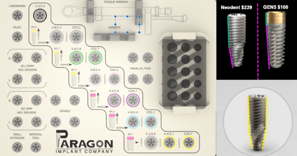 Shortcomings of NEODENT’s® GM Implants – Paragon Implant