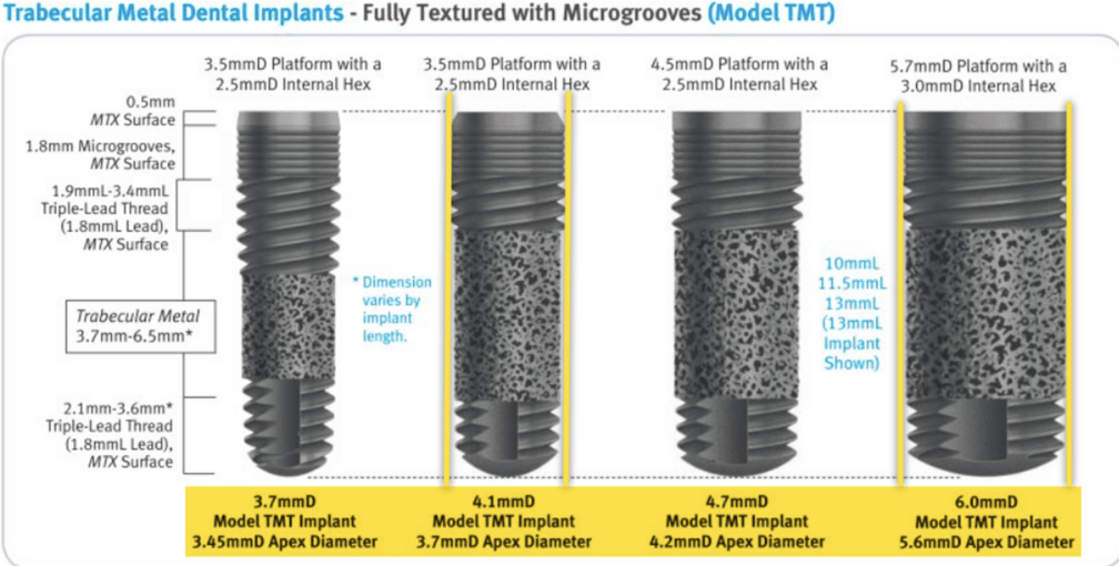 Shortcomings of ZimVie’s Tapered Screw-Vent with Trabecular Metal ...