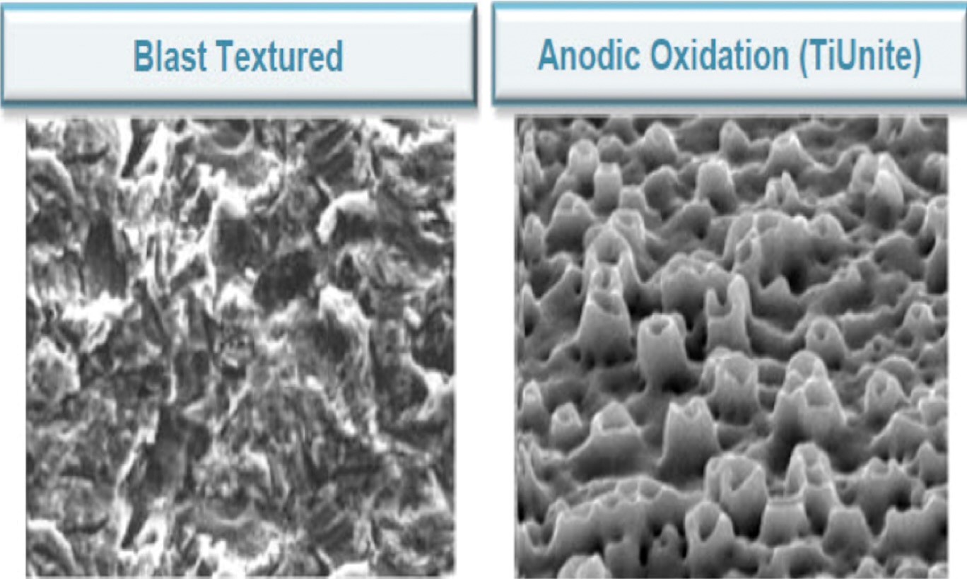 Shortcomings of NobelActive™ Implant in Contrast to Paragon’s TriActive ...