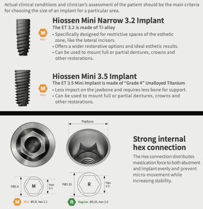 Shortcomings of Hiossen’s® Implants – Paragon Implant
