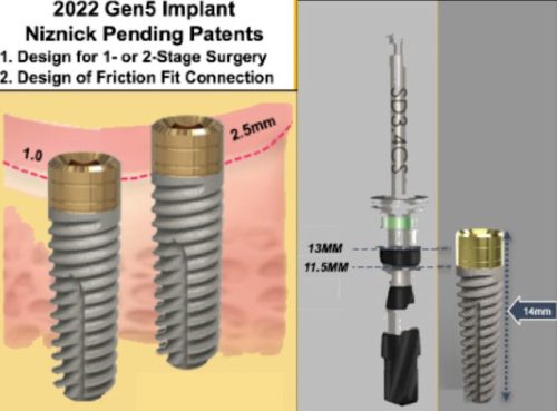 Shortcomings of NEODENT’s® GM Implants – Paragon Implant