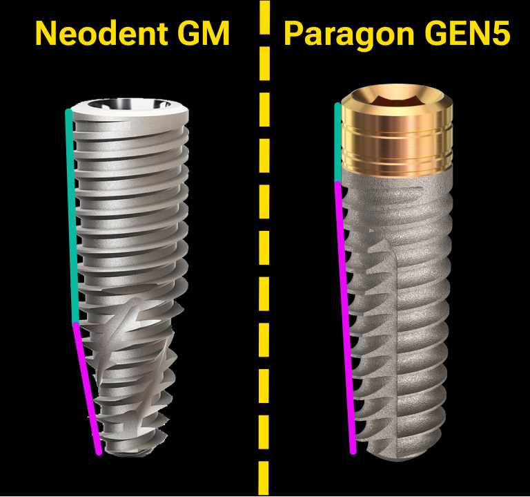 Shortcomings of NEODENT’s® GM Implants – Paragon Implant