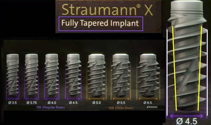 Shortcomings of Straumann’s® Bone-Level Implants in Contrast to Paragon’s TriFit™ Implant ...