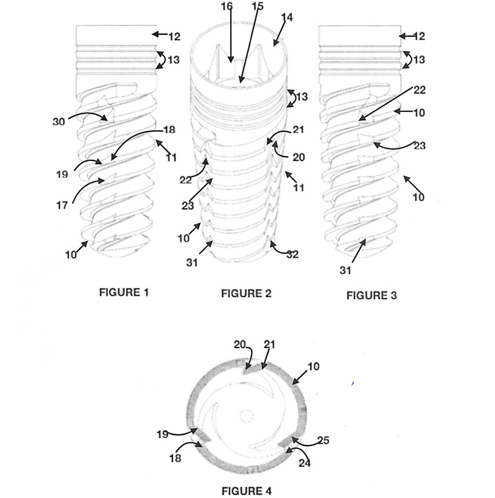 Shortcomings of Straumann’s® Bone-Level Implants in Contrast to Paragon ...